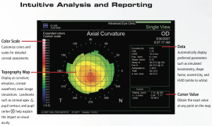 Zeiss Atlas 9000 Corneal Topographer - My Eye Equipment